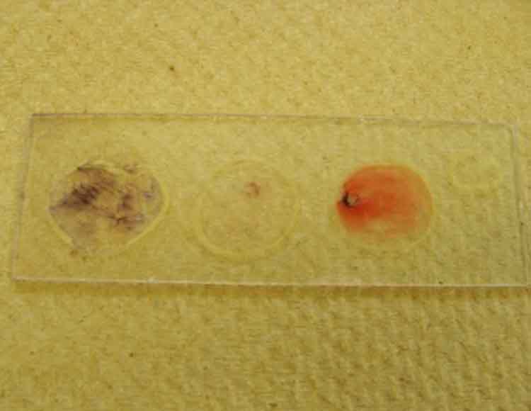 Gram Stain Microbiology Images: Photographs